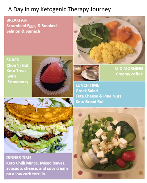 SCOPe HSCP Voice | Happy International Epilepsy Day! | St James's Hospital