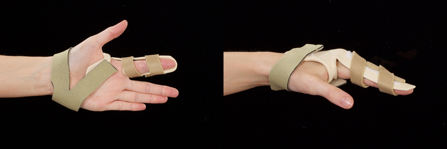 St James's Intrinsic & SAM | St James's Hospital