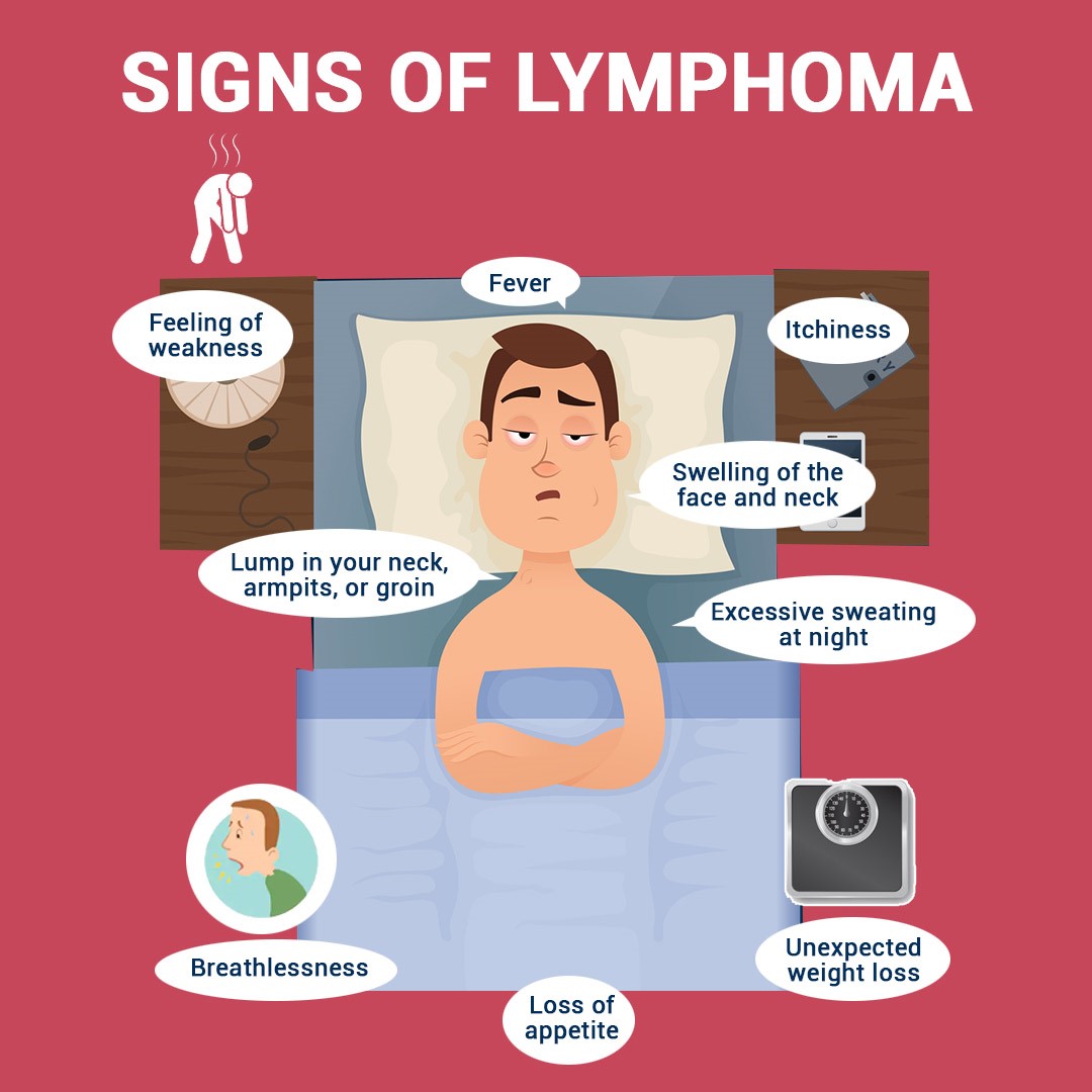 2021 | Know The Warning Signs Of Lymphoma | St James's Hospital