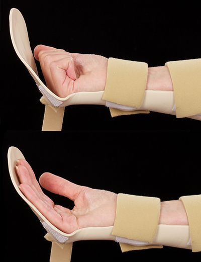 Modified Belfast Regime | St James's Hospital