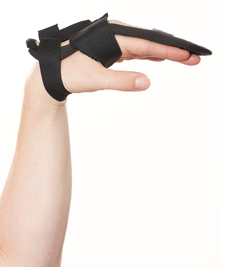 Manchester Short Splint | St James's Hospital