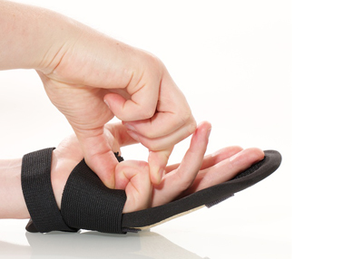 Manchester Short Splint | St James's Hospital